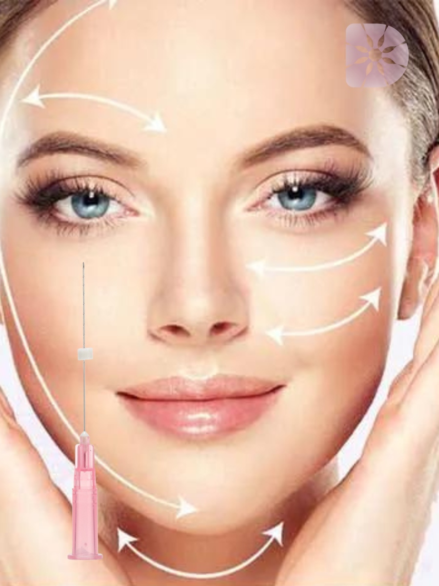 PLLA Screw Threads Bag of 50 – the7